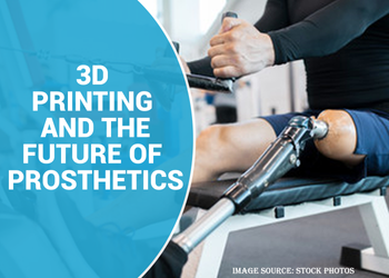 3D Printing and the Future of Prosthetics