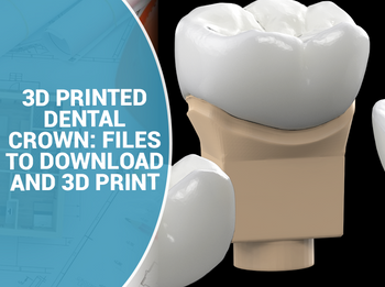 3D Printed Dental Crowns: 10 Best Options to Download and 3D Print