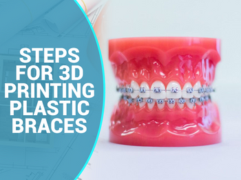Steps on How to 3D Print Plastic Braces