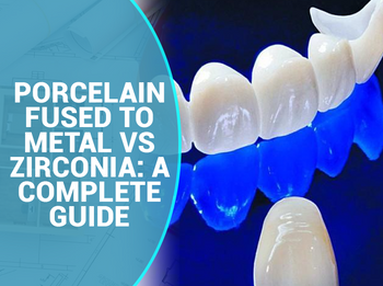 Porcelain Fused to Metal vs. Zirconia-A Complete Guide