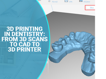 3D Printing in Dentistry-From 3D Scans to CAD to 3D Printer
