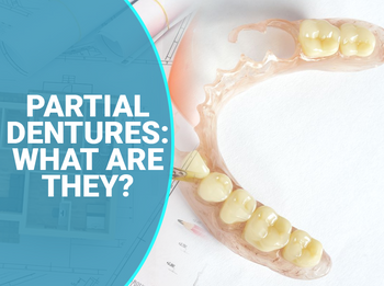 Partial Dentures-What Are They?