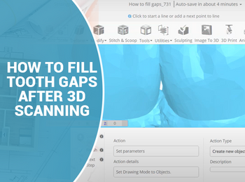 How to Fill Tooth Gaps After 3D Scanning
