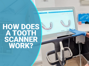 How Does a Tooth Scanner Work