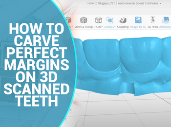 How to Carve Perfect Margins on 3D Scanned Teeth in SelfCAD