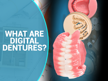 What are Digital Dentures?