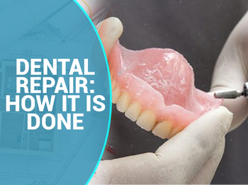 Dental Repair-How it is Done